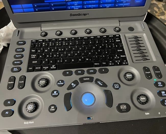 SonoScape E2 Pro Ultrasound - Regenco Biologics